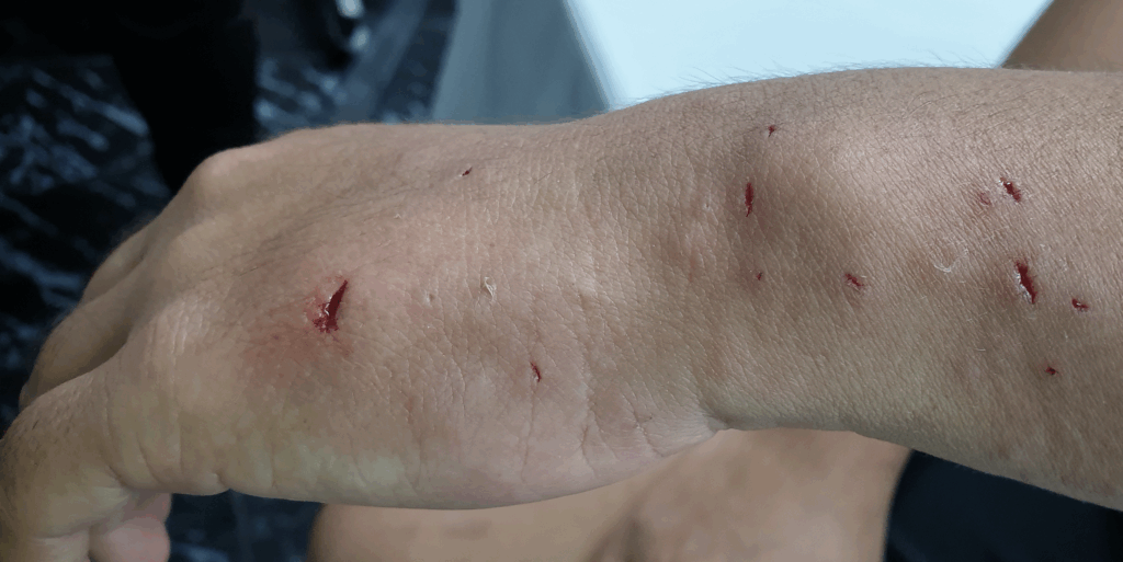 What To Do After a Dog Bite Attack | Daniel Stark Injury Lawyers